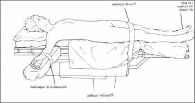 ENFERMERÍA QUIRÚRGICA: POSICIONES QUIRURGICAS